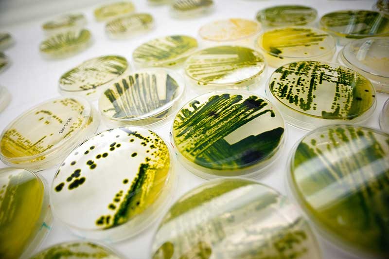 Solazyme's Q1 results focus on progress at Brazil algal oil plant ...